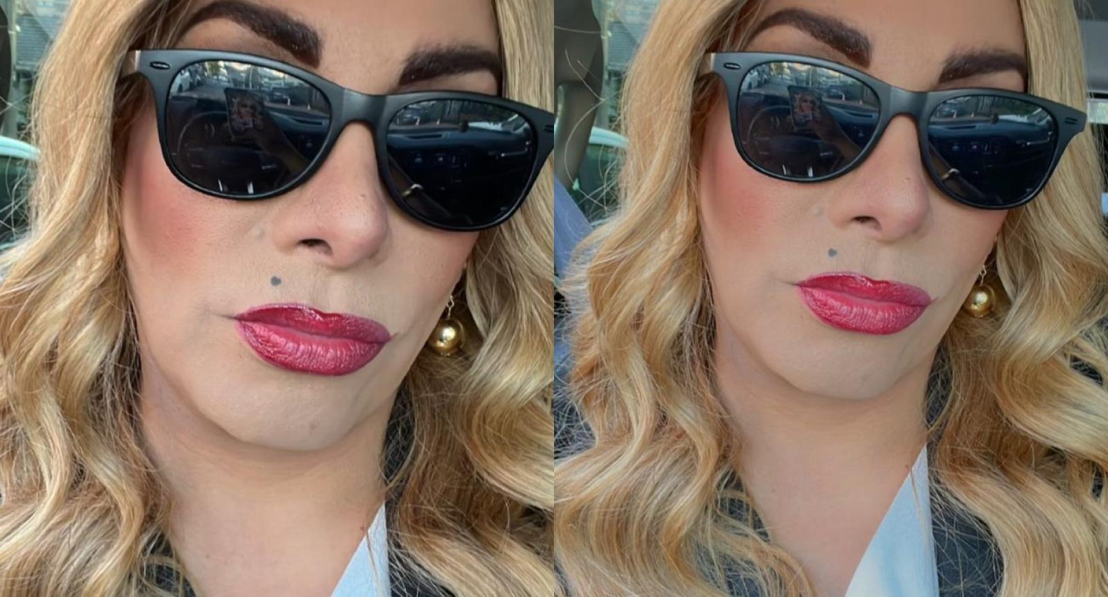 El resultado final tras operarse: Botota Fox presume su tonificado ...