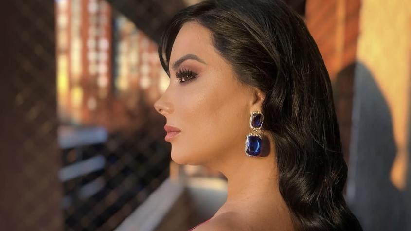 Exchica reality sufrió filtración de íntimas fotos y videos tras robo: "Me da vergüenza salir a ...